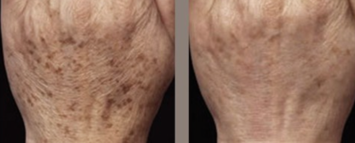 specials | Plano Allergy Doctor | Dallas Allergists | Clear AI